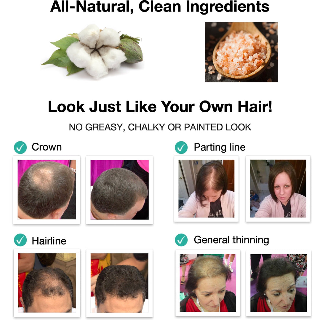 Caboki Hair Building Fiber, All-Natural Hair Loss Concealer 30 Gram ...