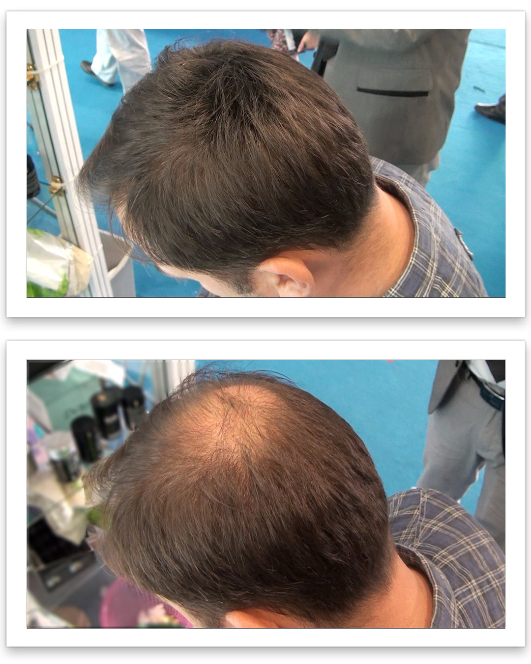 Hair Building Fiber For Thinning Hair - Caboki All-Natural Hair Loss ...