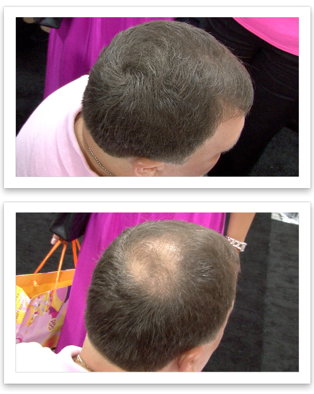 Hair Building Fiber For Thinning Hair - Caboki All-Natural Hair Loss ...