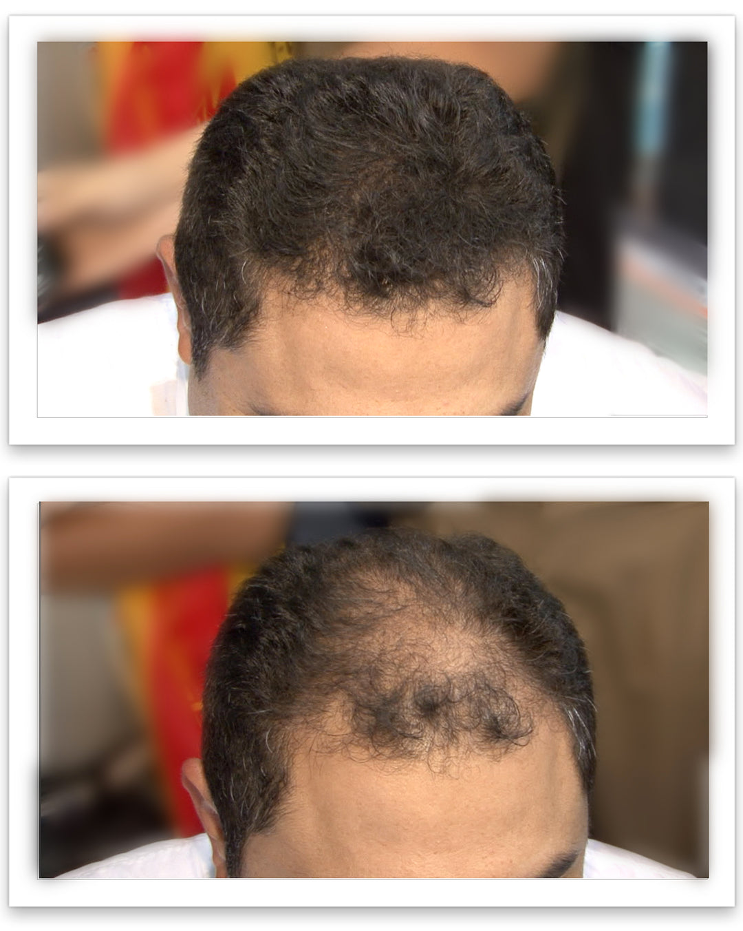 Hair Building Fiber For Thinning Hair - Caboki All-Natural Hair Loss ...