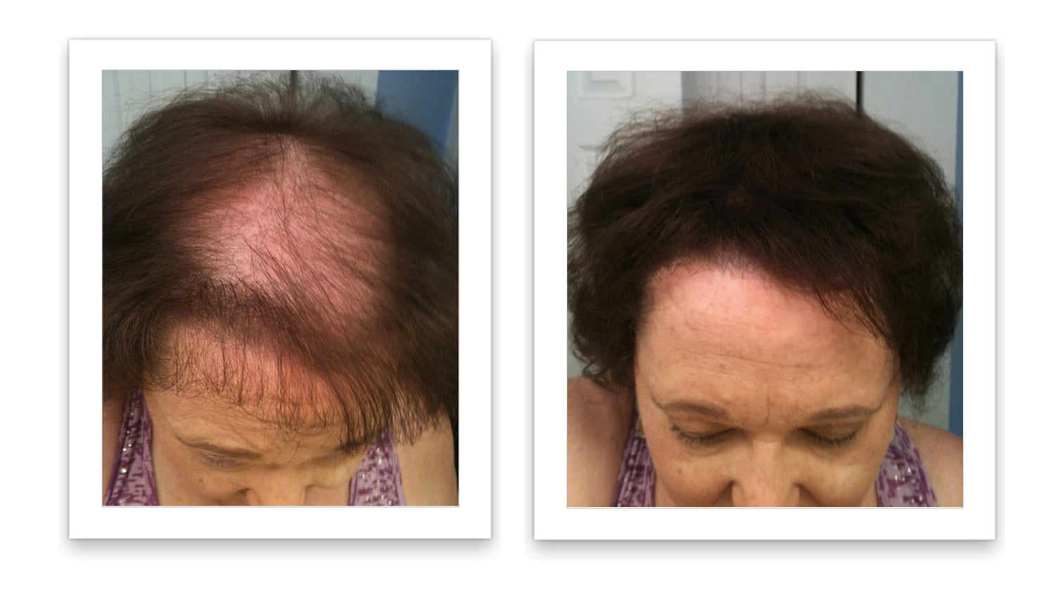 Caboki Hair Building Fiber, All-Natural Hair Loss Concealer, Best ...